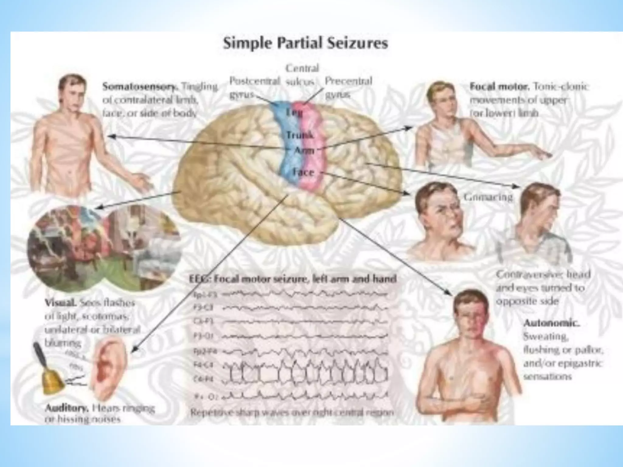 Epilepsy Types | PPTX | Brain and Nervous System Disorders | Diseases ...