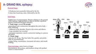 epilepsy and status epilepticus for undergraduate.pptx