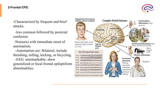 epilepsy and status epilepticus for undergraduate.pptx
