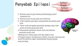 Epilepsi | PPTX