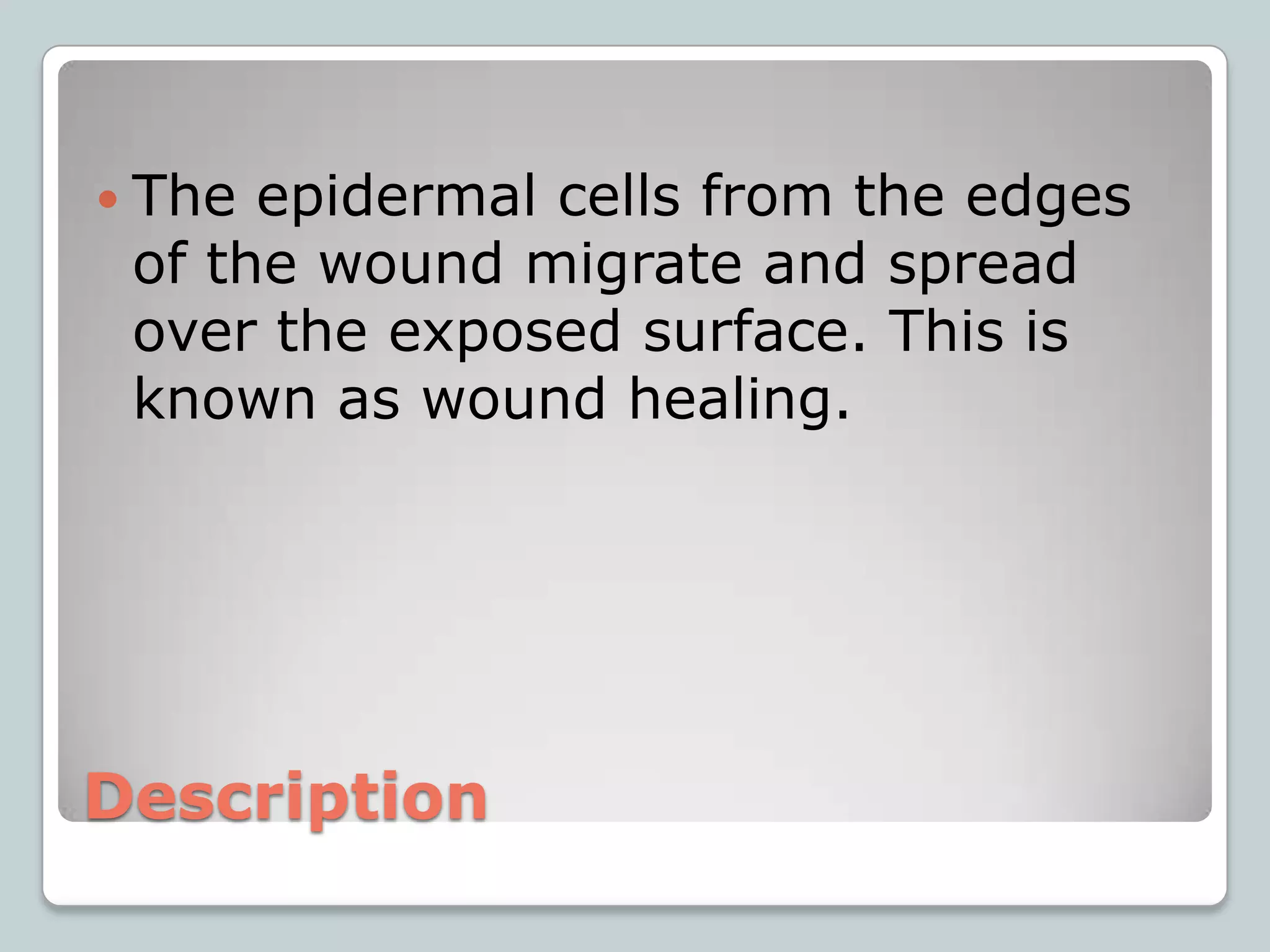 Epimorphic regeneration science project | PPTX