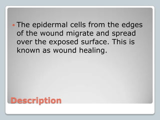 Epimorphic regeneration science project | PPT