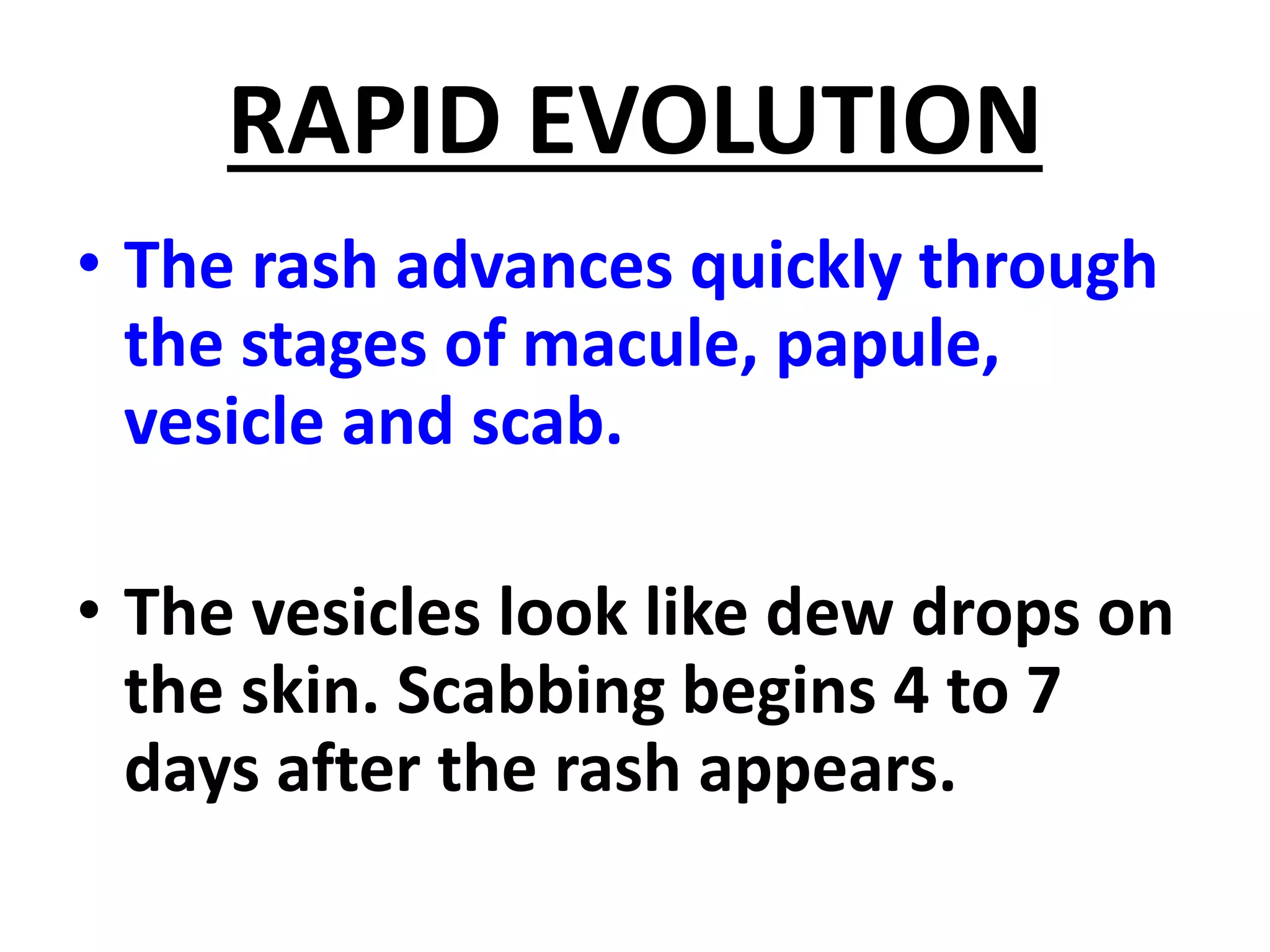 EPIDEMIOLOGY OF CHICKEN POX | PPTX