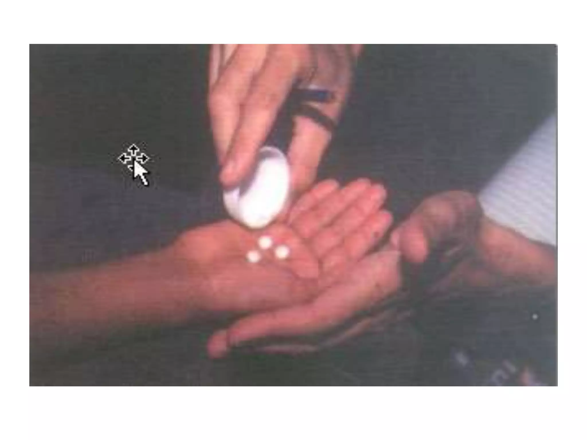 EPIDEMIOLOGY OF FILARIASIS | PPTX