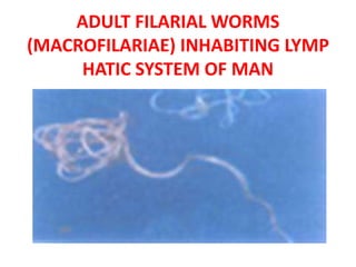 EPIDEMIOLOGY OF FILARIASIS | PPTX