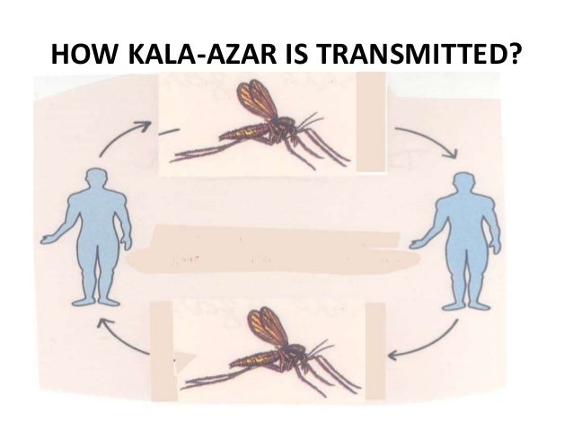 EPIDEMIOLOGY OF KALA AZAR