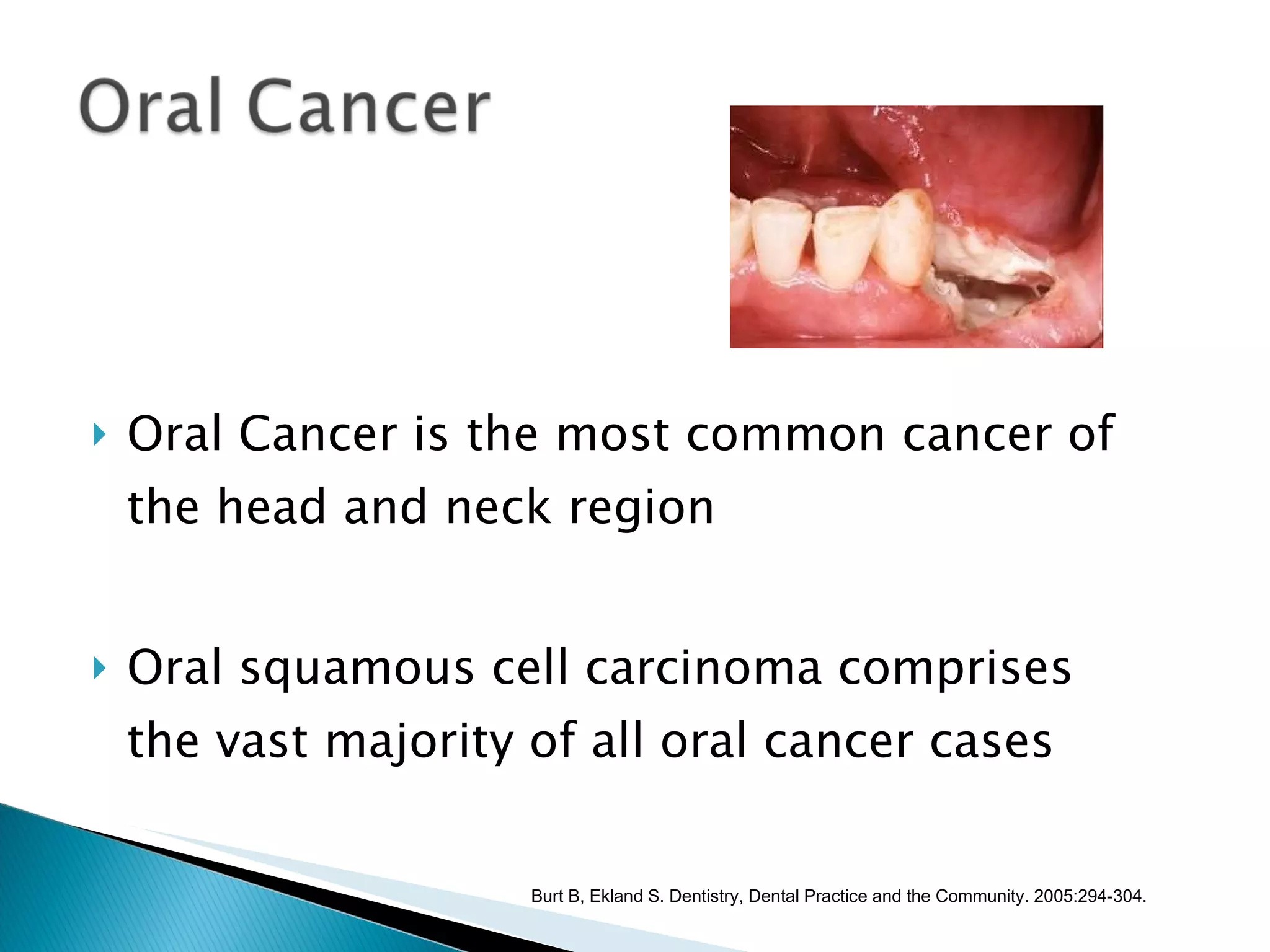 Epidemiology of Oral Cancer | PPT
