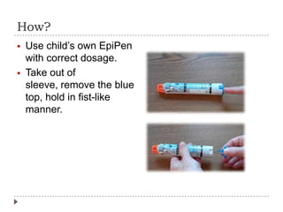 Anaphylaxis and EpiPen | PPTX