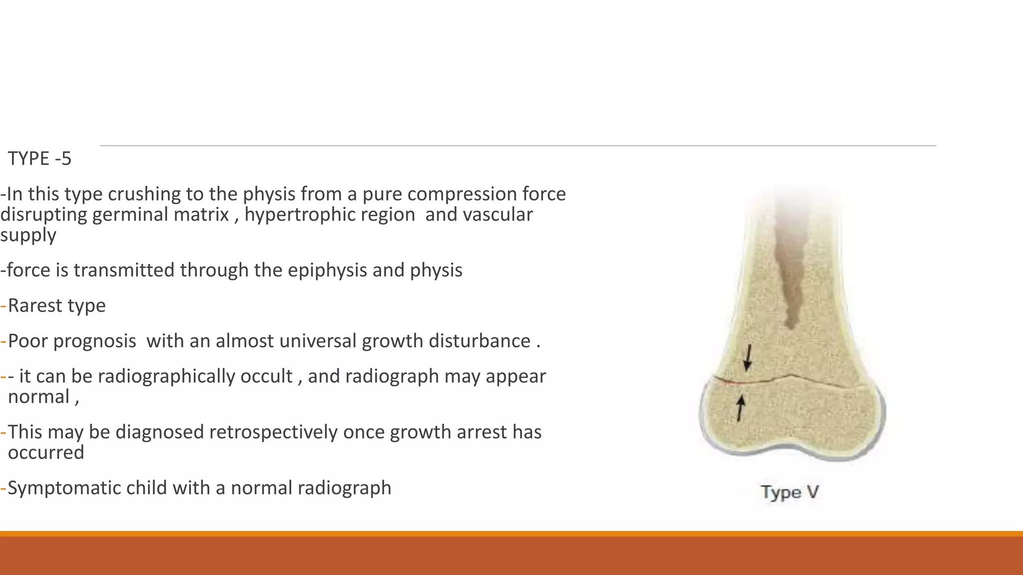 epiphseal injuries.pptx
