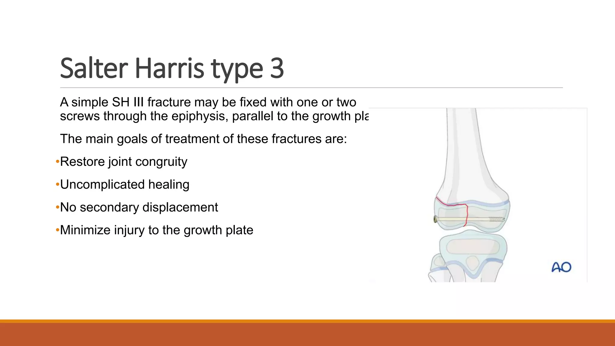 epiphseal injuries.pptx