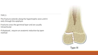 epiphseal injuries.pptx