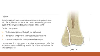 epiphseal injuries.pptx