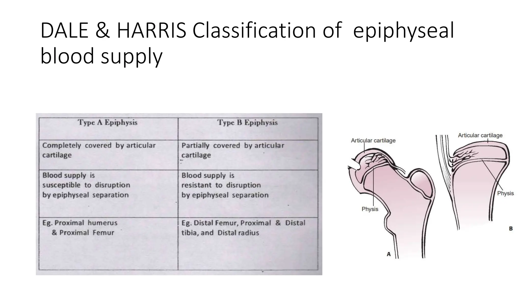 epiphyseal injuries.pptx