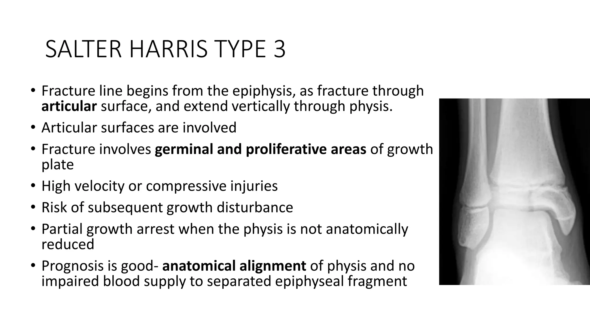 epiphyseal injuries.pptx
