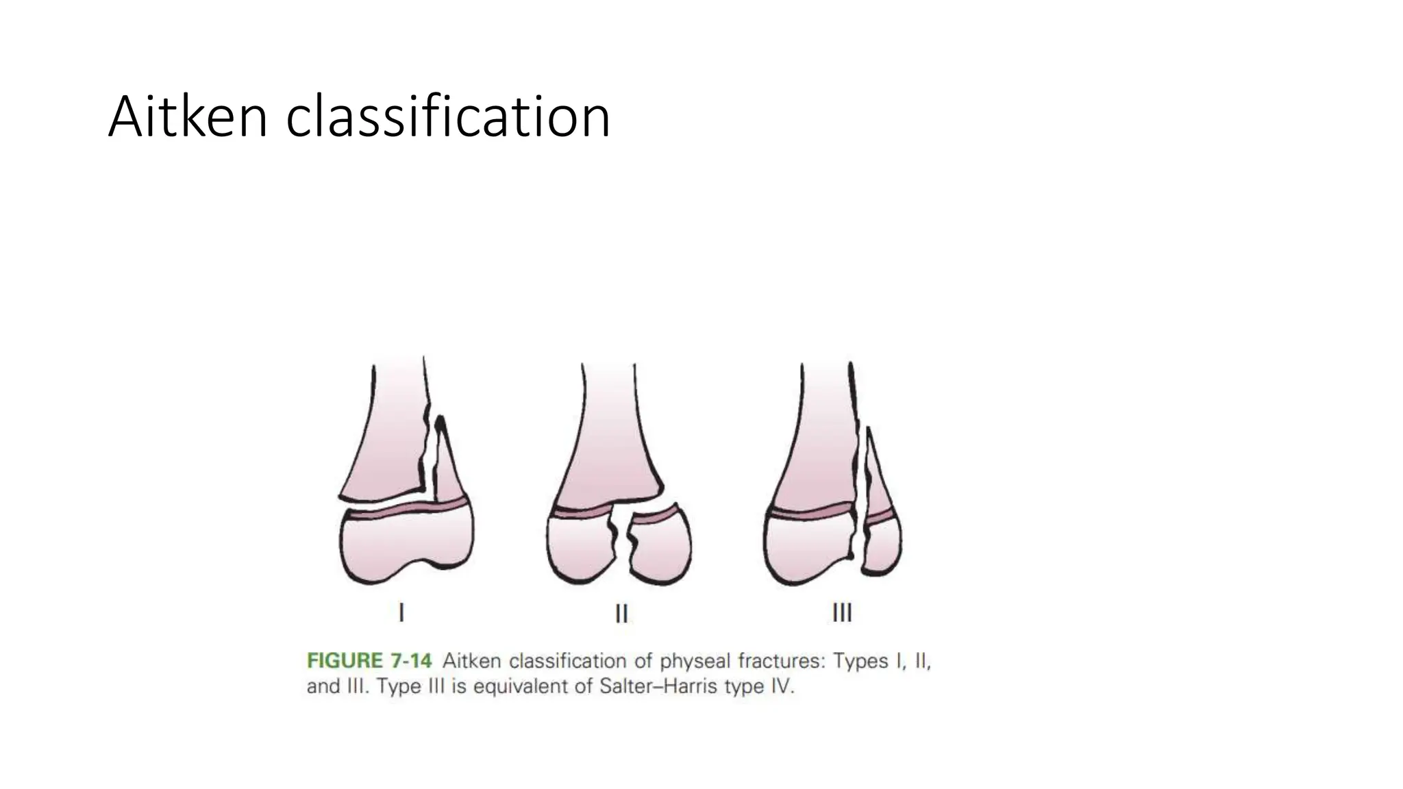 epiphyseal injuries.pptx