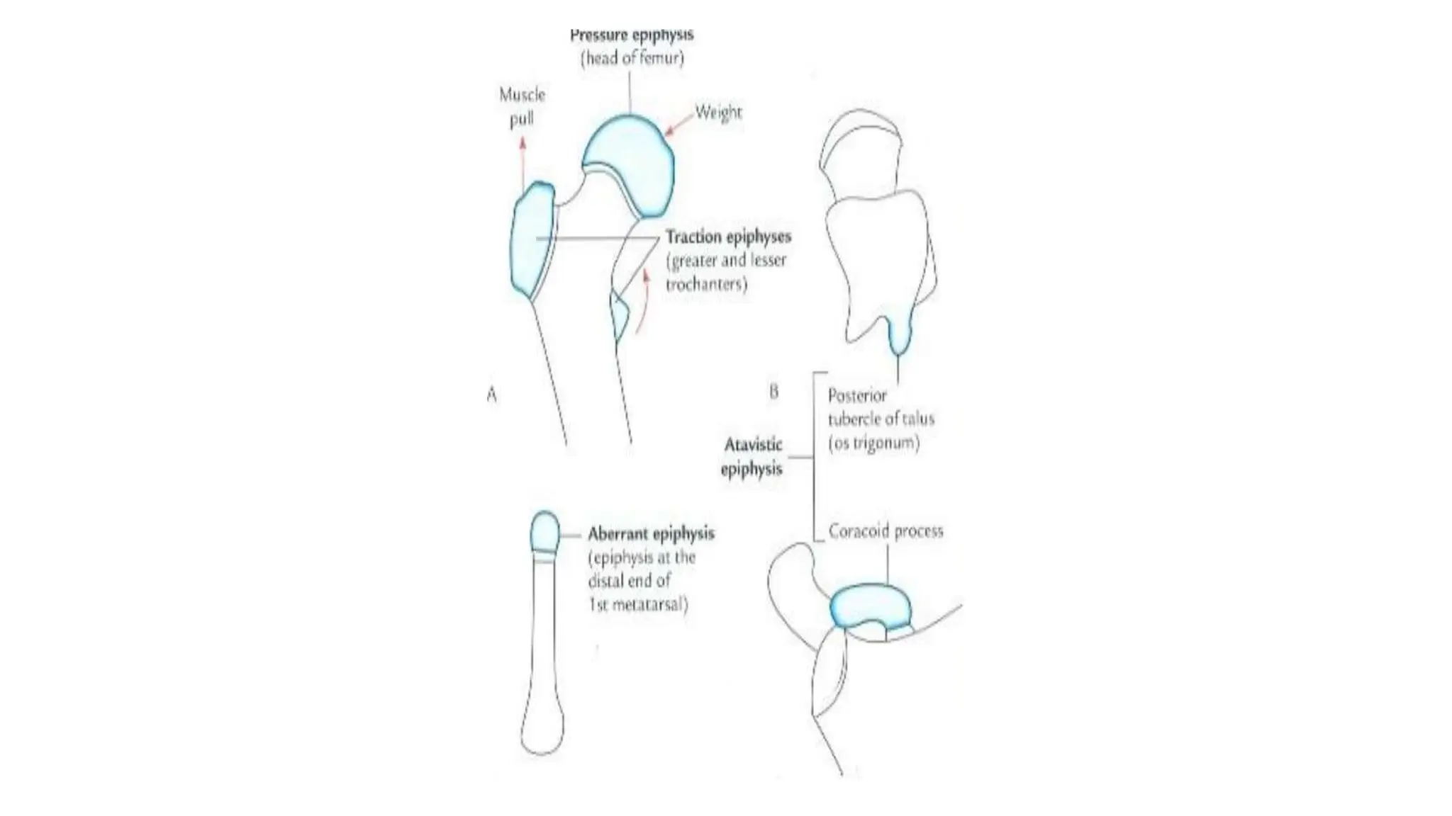 epiphyseal injuries.pptx