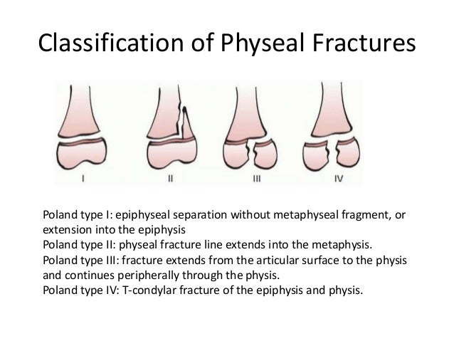 Epiphyseal injury april 2016 sdumc