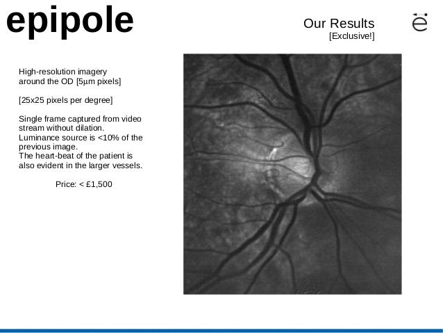 Epipoles Investment Journey