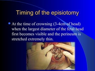 Epi ppt | PPT | Pregnancy | Reproductive Health