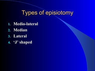 Epi ppt | PPT | Pregnancy | Reproductive Health