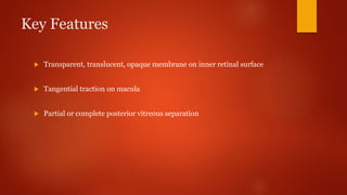 Epiretinal membrane | PPTX