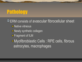 NW2010 Epiretinal membrane | PPT