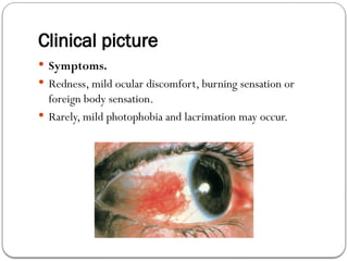 Episcleritis and Scleritis etiology and management | PPTX