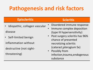 Episcleritis Vs Scleritis
