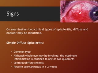 Episcleritis and scleritis.ppt