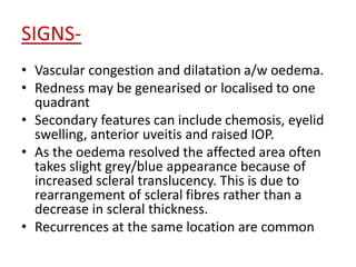 EPISCLERITIS AND SCLERITIS.pptx bbbbbbbb | PPTX