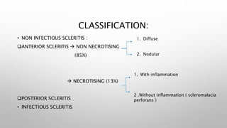 EPISCLERITIS AND SCLERITIS OF THE EYE BALL | PPT