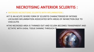 EPISCLERITIS AND SCLERITIS OF THE EYE BALL | PPT