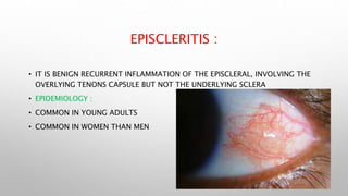 EPISCLERITIS AND SCLERITIS OF THE EYE BALL | PPT