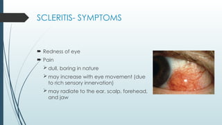 EPISCLERITIS AND SCLERITIS- PRESENTATION.pptx