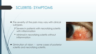 EPISCLERITIS AND SCLERITIS- PRESENTATION.pptx