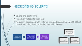 EPISCLERITIS AND SCLERITIS- PRESENTATION.pptx