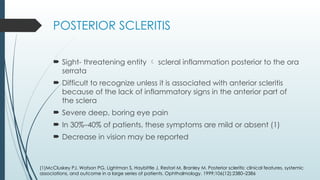 EPISCLERITIS AND SCLERITIS- PRESENTATION.pptx