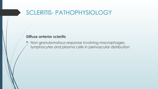 EPISCLERITIS AND SCLERITIS- PRESENTATION.pptx