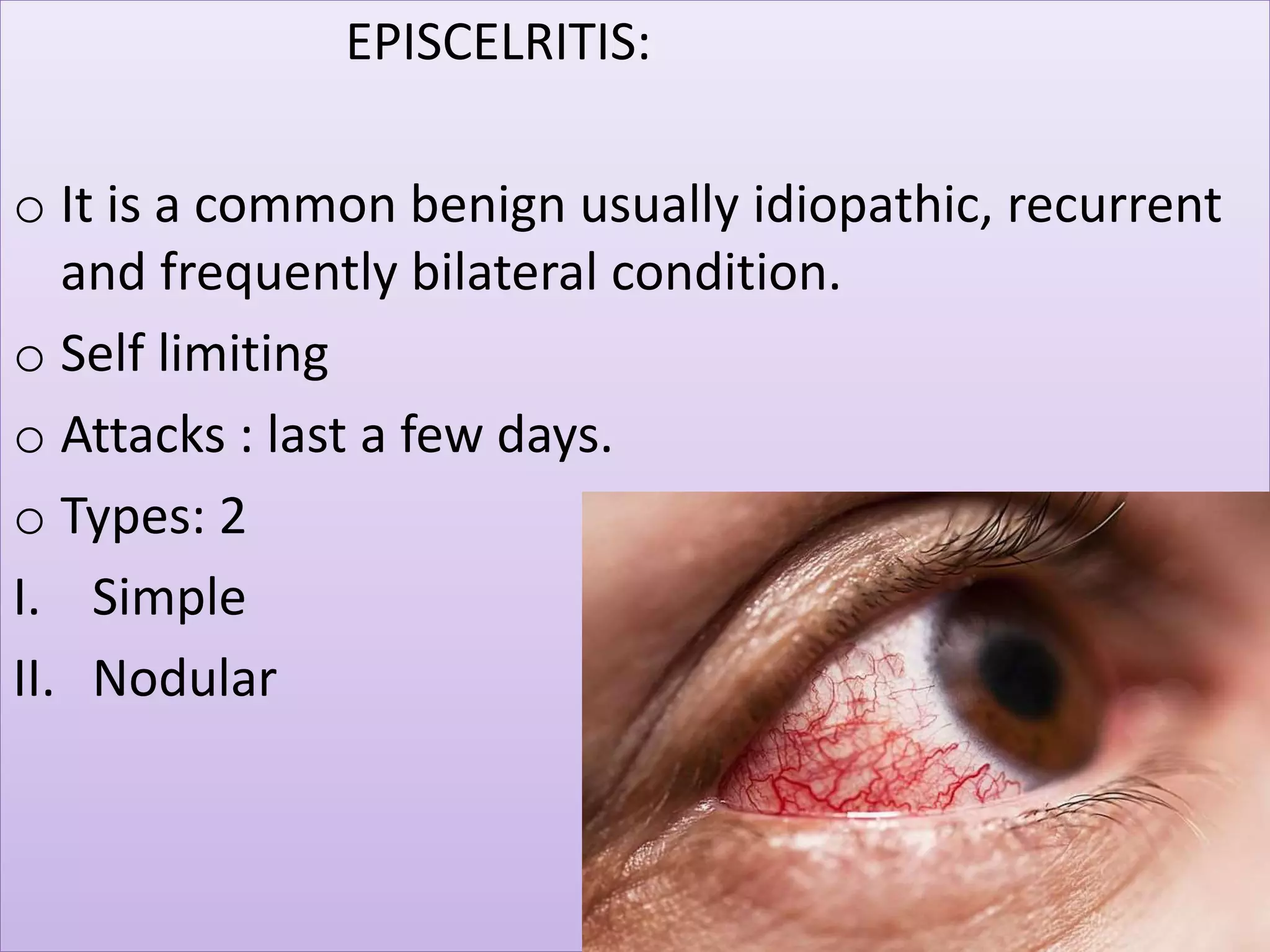 Episcleritis and scleritis (ophthalmology) | PPT