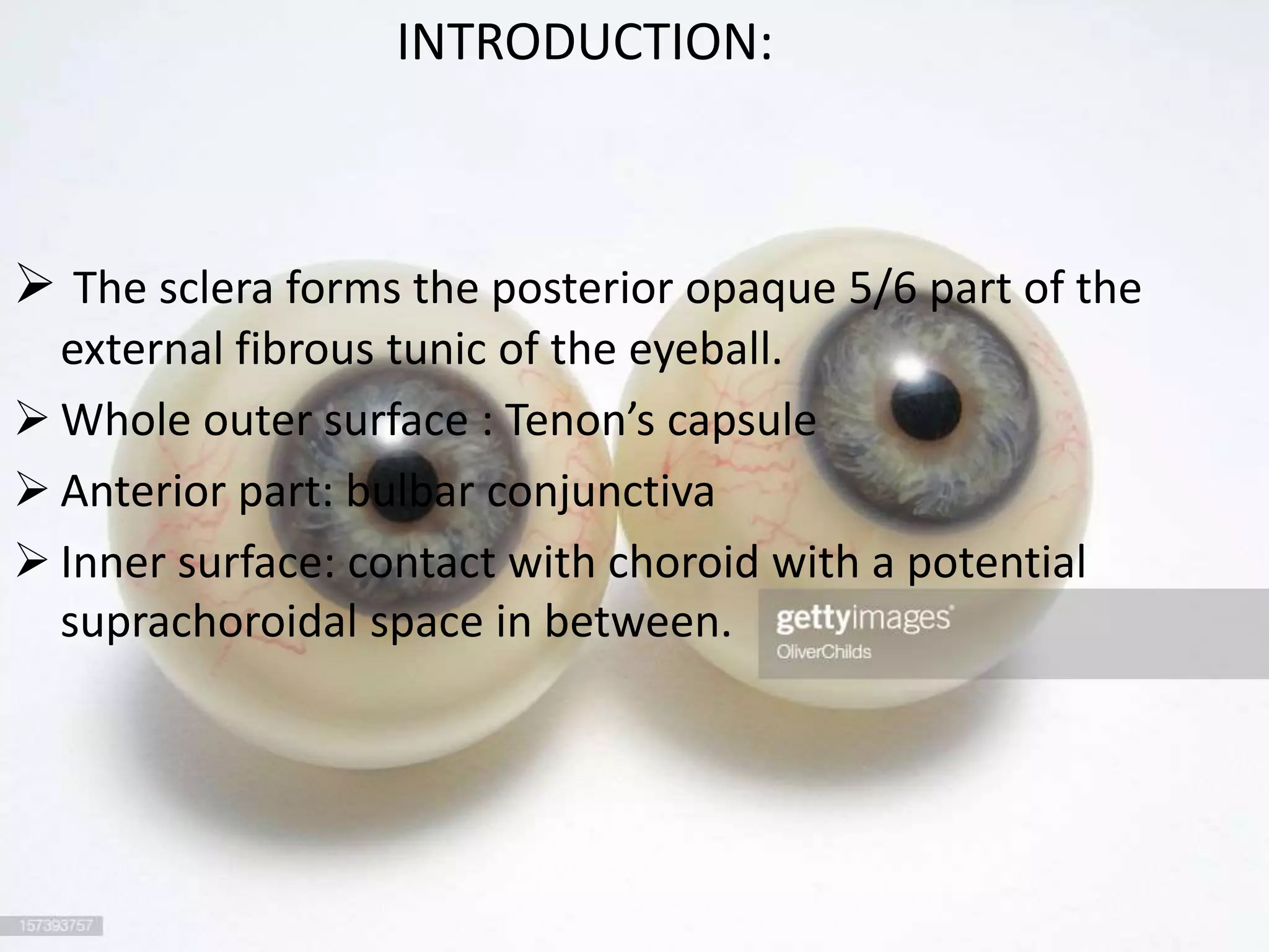 Episcleritis and scleritis (ophthalmology) | PPTX