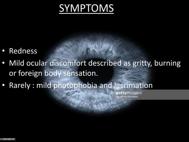 Episcleritis and scleritis (ophthalmology) | PPTX | Eye and Vision ...
