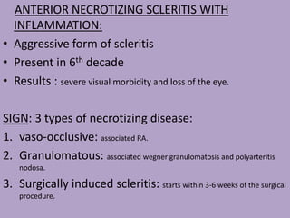 Episcleritis and scleritis (ophthalmology) | PPTX
