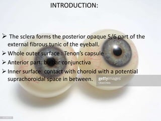Episcleritis and scleritis (ophthalmology) | PPTX