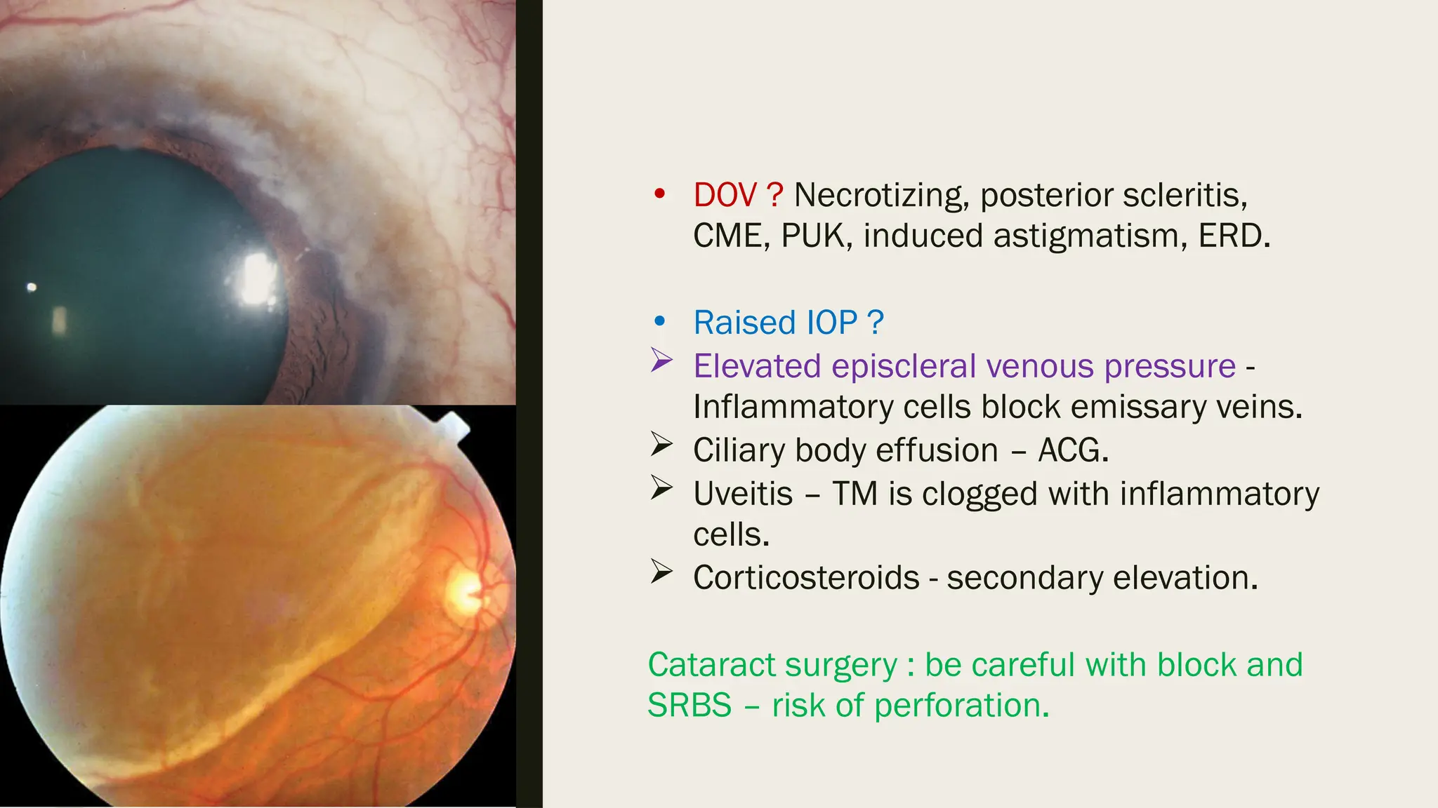 Episcleritis & Scleritis (causes, clinical features, treatment).pptx