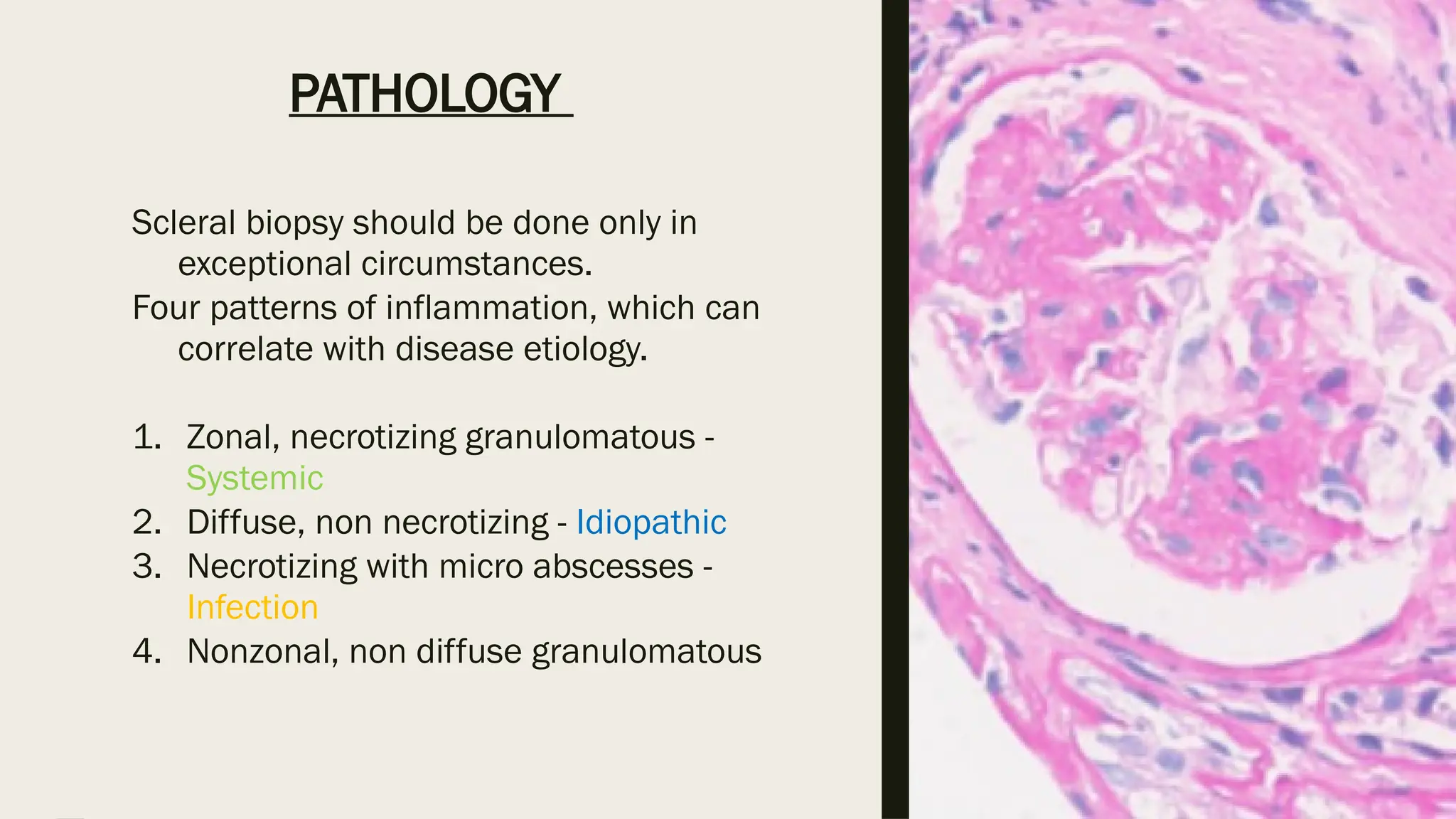 Episcleritis & Scleritis (causes, clinical features, treatment).pptx