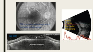 Episcleritis & Scleritis (causes, clinical features, treatment).pptx