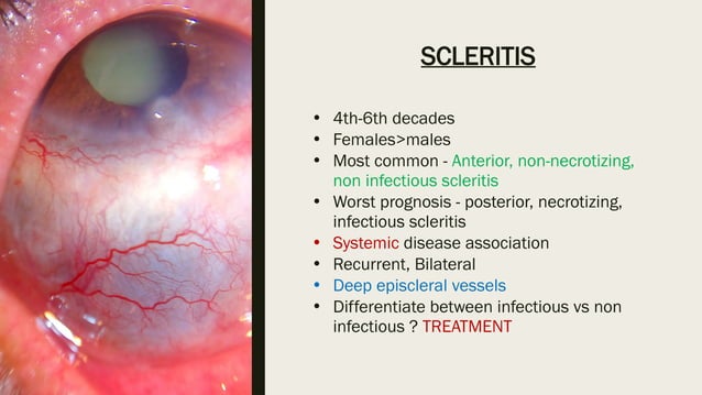 Episcleritis & Scleritis (causes, clinical features, treatment).pptx
