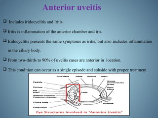 EPISCLERITIS & UVEITIS.ppt eye disorders | PPT