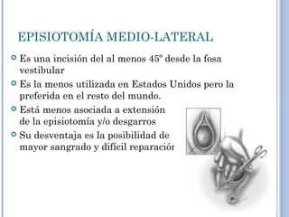La Episiotomía | PPT
