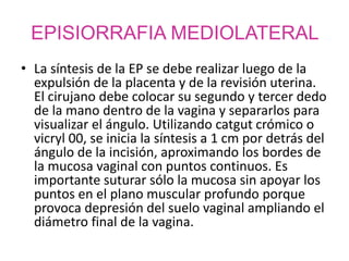 Episiotomía | PPTX